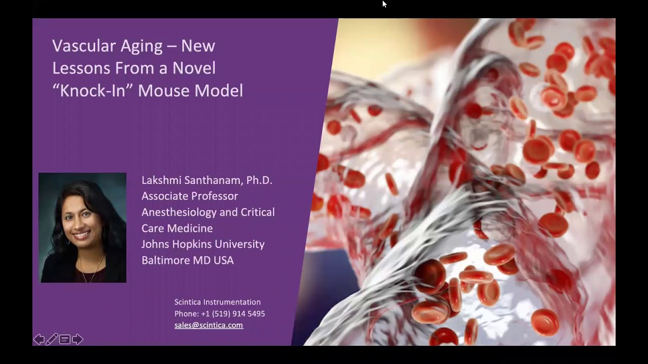 Vascular Aging – New Lessons From a Novel “Knock-In” Mouse Model