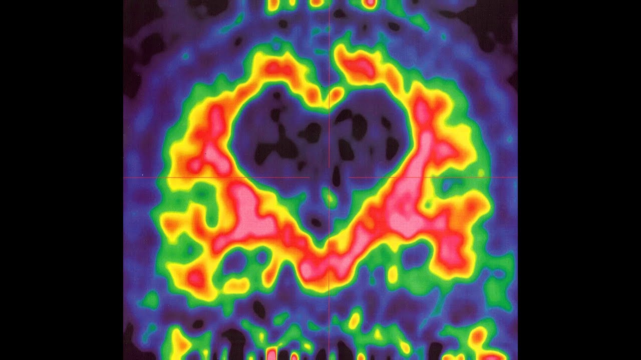 Master's Degree Programme in Biomedical Imaging - BIMA2017