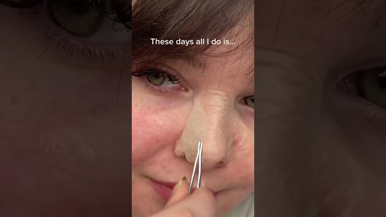 What happens after wearing 3 Mighty Patches for 8 hours? 👀