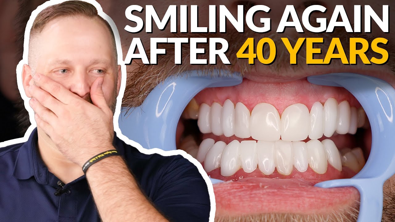 No Cosmetic Dentist No Dental Implants- See Improved Smile Makeover in 2.5 Seconds