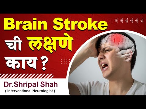 Brain Stroke ची लक्षणे काय? Dr.Shripal Shaha