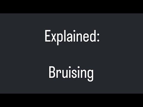 Bruising explained