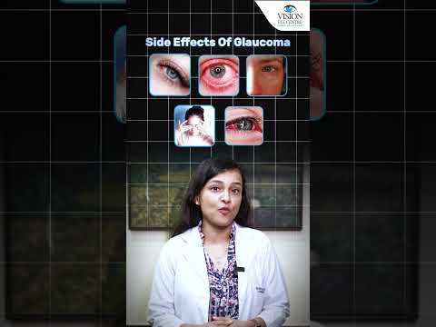 Glaucoma Eye Drops: Side Effects You Need to Know | Red Eyes? Watering? cause You Must Know