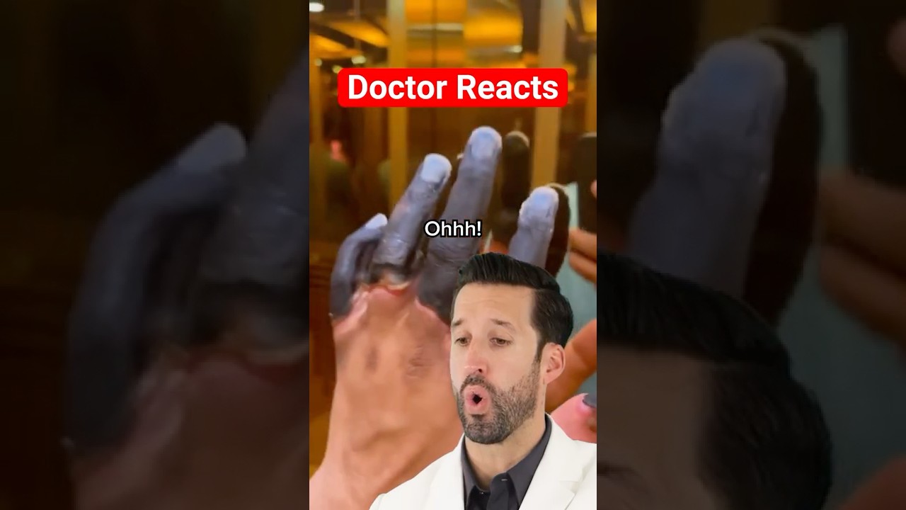 ER Doctor REACTS to 