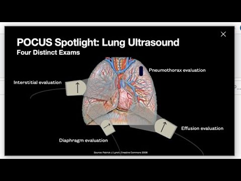 雙和急診超音波教學-Lung US & BLUE protocol – POCUS Academy
