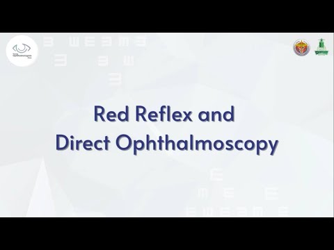 Red Reflex Ophthalmoscope
