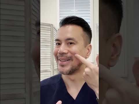Easily Remove Wrinkles Using Tunable Resurfacing Laser (TRL) - Part 2
