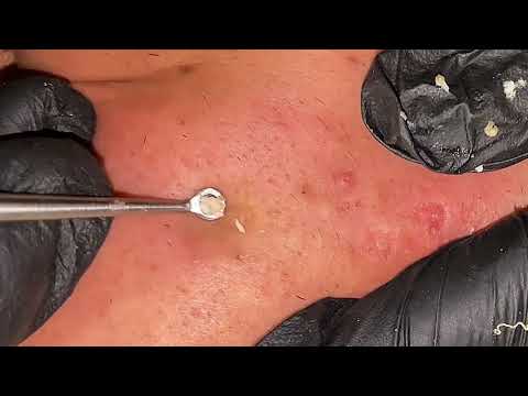 Skincare satisfying videos by Mahmoud Gamal #2006