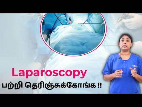 Laparoscopy பற்றி தெரிஞ்சுக்கோங்க !! Advantages | Uses | After Surgery Care