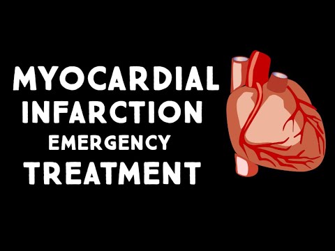 Myocardial Infarction (MI,Heart Attack) Treatment in Emergency | Step wise STEMI Management USMLE