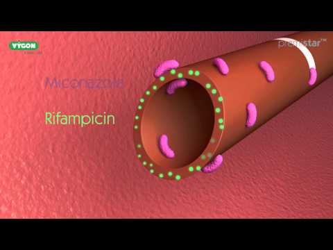Premistar - The 1Fr neonatal catheter with antimicrobial technology