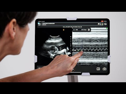 Fetal Heart M-mode
