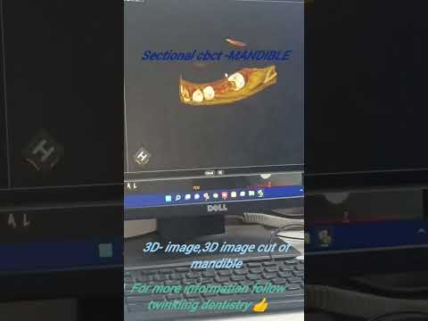 sectional cbct image- 3D image🔎🧑⚕️