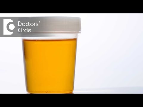 Criteria to declare urine as abnormal - Dr. Ravish I R