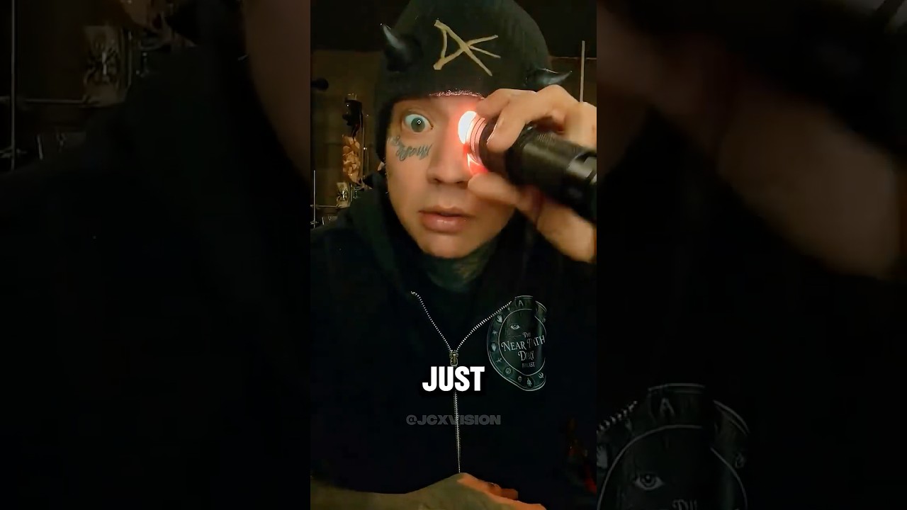 POV: Boy Tried to Fix His Eyes and Made It Way Worse💀🤣