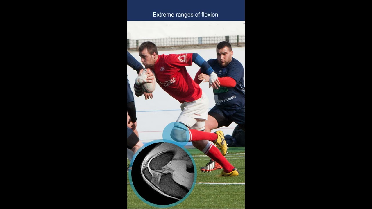 Multi-position MR imaging with MROpen Evo