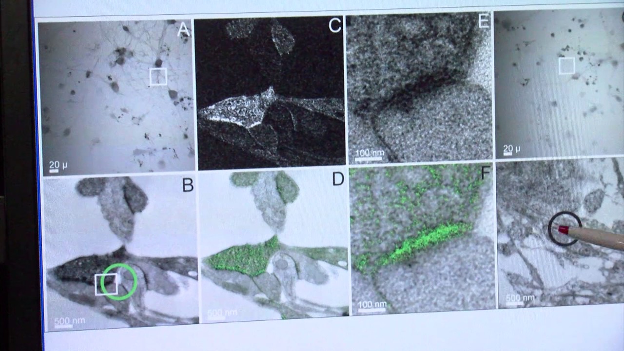 San Diego Scientists Add Color To Black-And-White Electron Microscopes