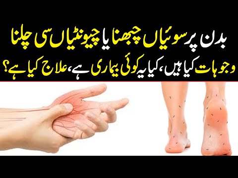 What is it called when you get needles in your skin? | Causes and Treatment in Urdu/Hindi