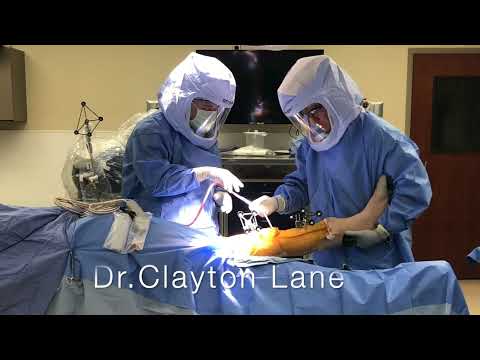 Mako Robotic Partial Knee replacement