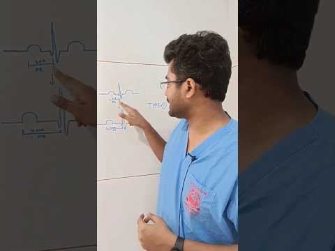 Do You Have a Minute || First Degree Heart Block #aetcm #emrapid