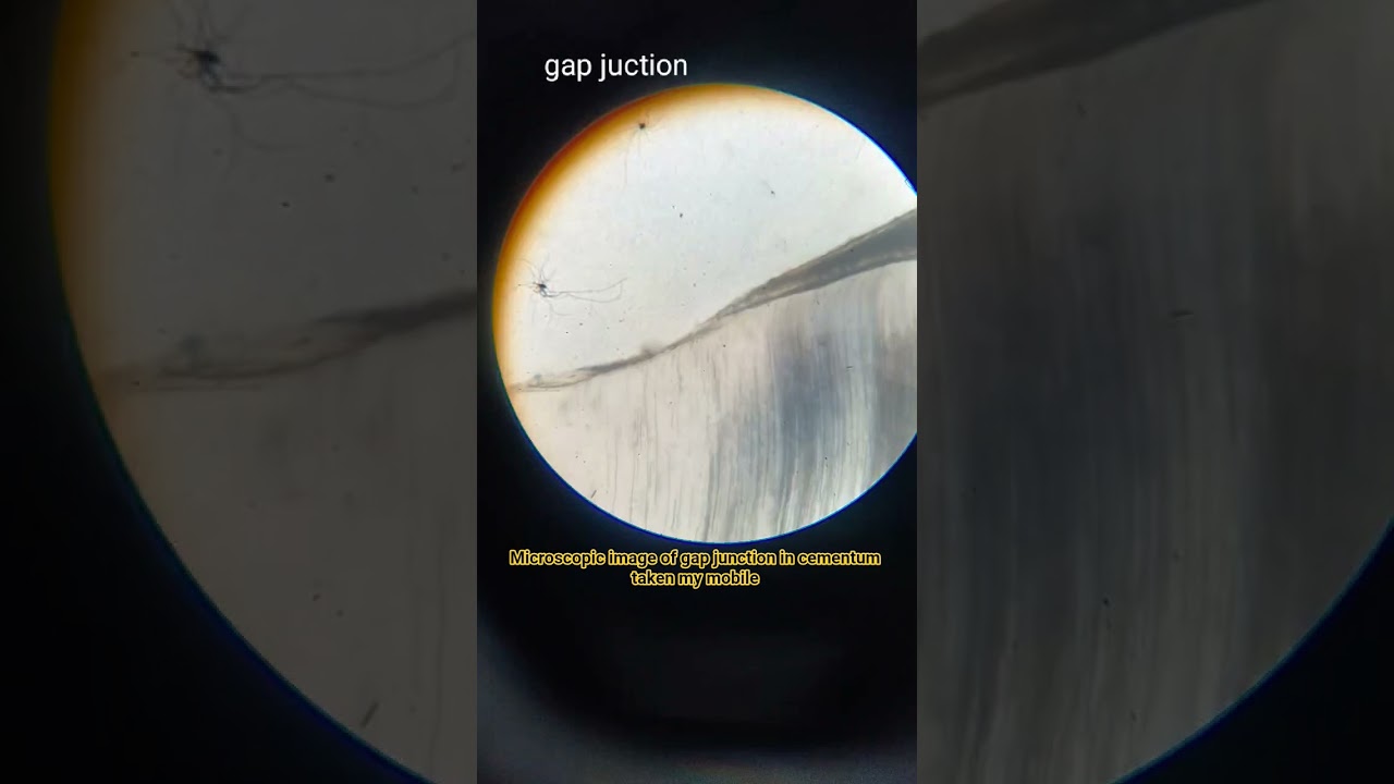 Gap Junction in cementum taken by Mobile phone #bds #dentist #shorts