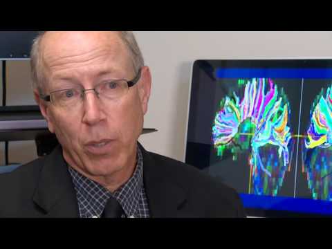 Study: 110 of 111 NFL brains test for C.T.E.