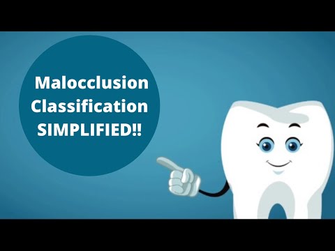Incisors, Canines and Molars Malocclusion Classification