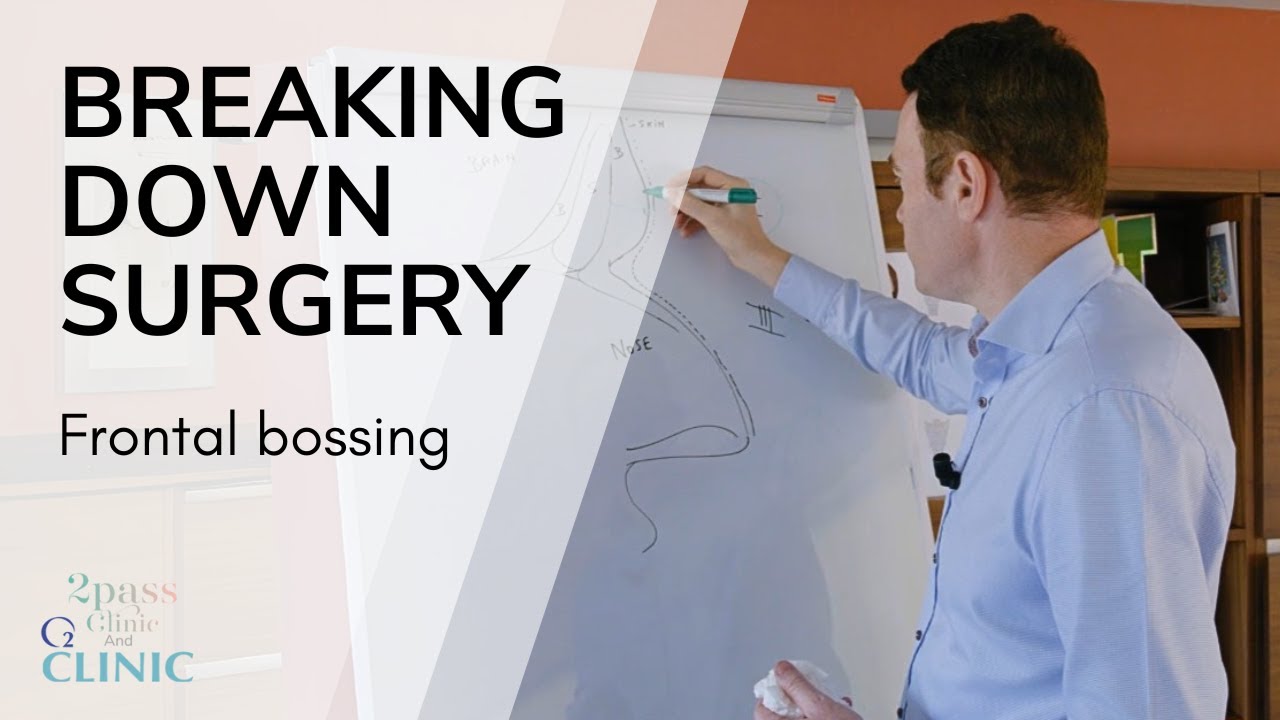 BREAKING DOWN SURGERY: Frontal bossing