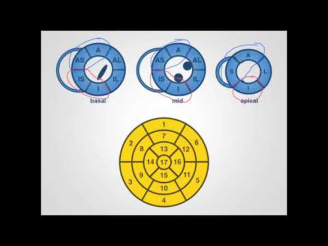 The fundamentals of left ventricular assessment in cardiac magnetic resonance imaging (CMR)
