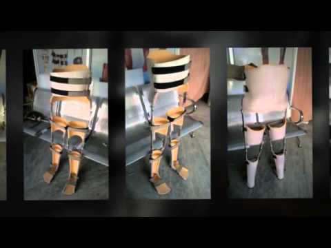 calipers for disabled - Hkafo Hip Knee Ankle Foot Orthosis Manufacturer ...