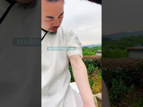 240522-Thyroid nodules, try it.