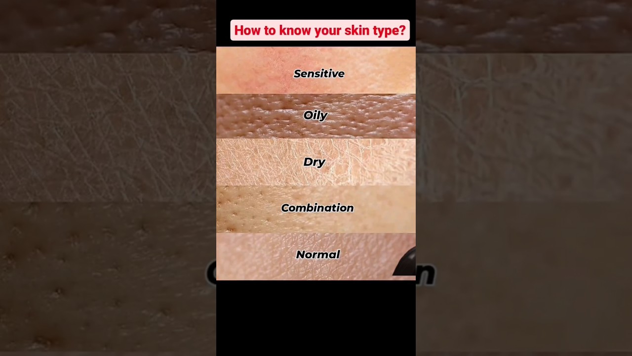 skin 5 #types