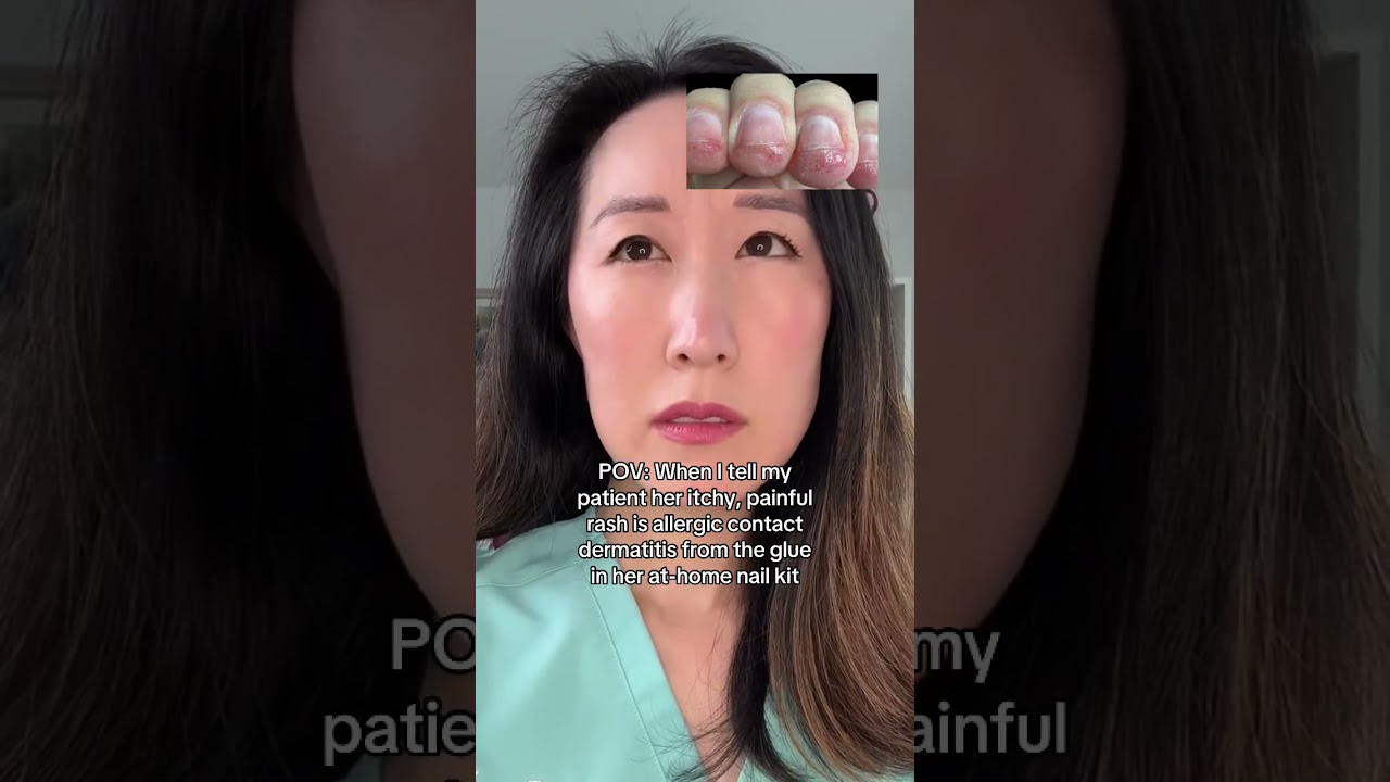 Allergic Reaction from Your Nail Kit?