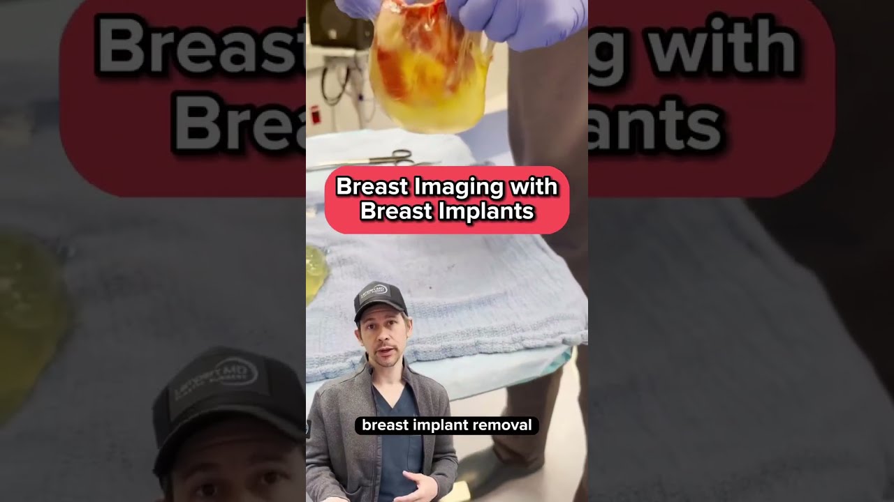 Breast Imaging with Breast Implants
