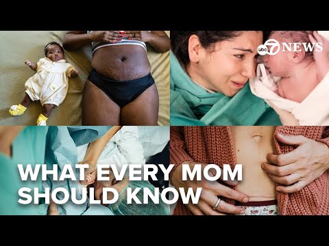 C-Section recovery moms should know about from a Pelvic Floor Therapist