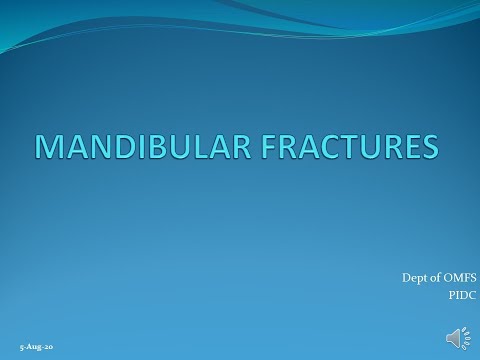 FRACTURES OF THE MANDIBLE