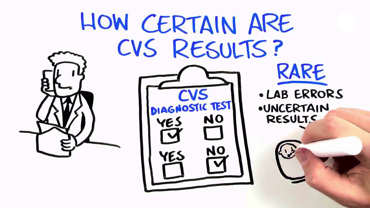 Prenatal Screening Options: Chorionic Villus Sampling (CVS)