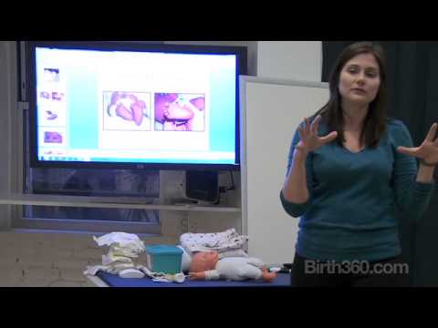 Newborn Appearance 3: Cyanotic Extremities