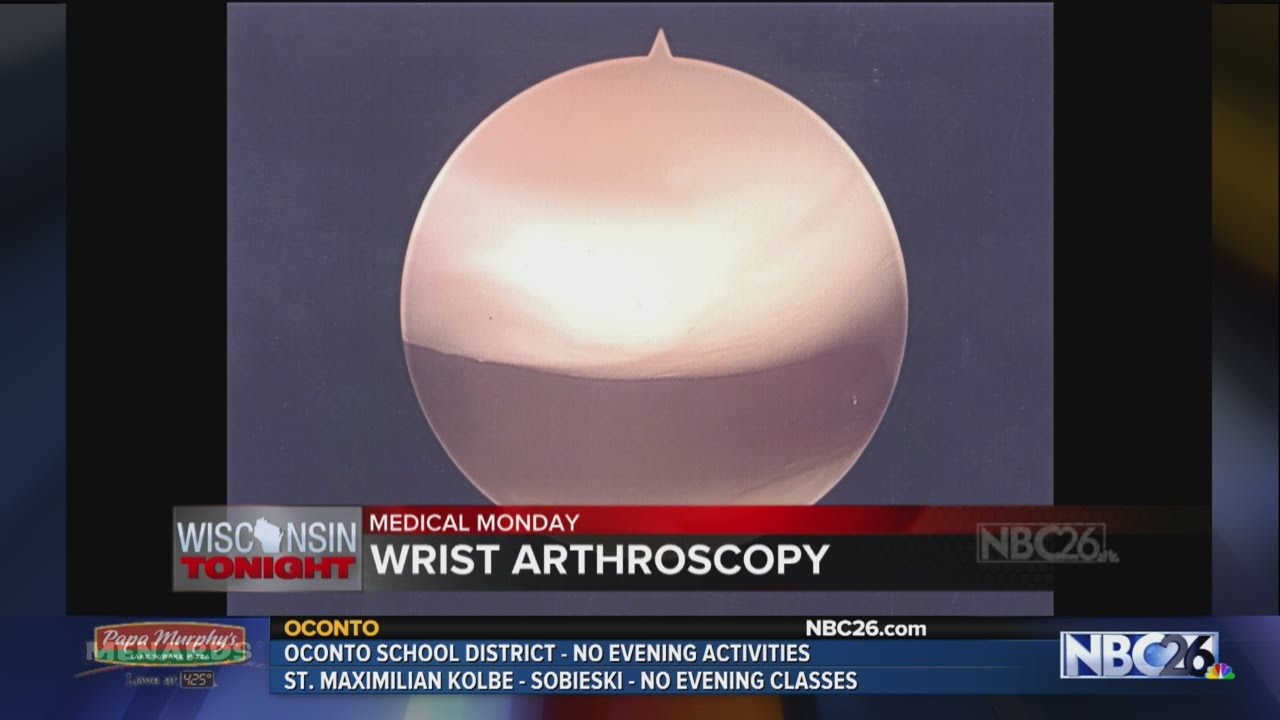 Medical Monday: What is a wrist arthroscopy and why do I need one?