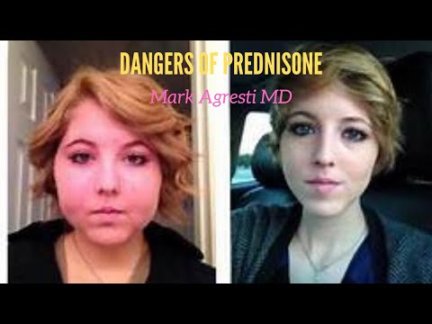 Prednisone (Corticosteroids) Are Helpfull and Dangerous Side Effects | Mark Agresti