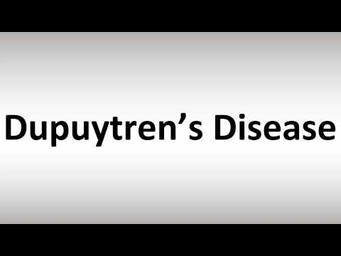 How to Pronounce Dupuytren’s Disease