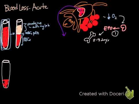 acute blood loss