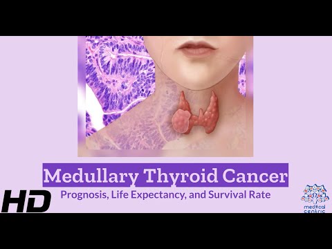 Navigating Medullary Thyroid Cancer: Prognosis Unveiled