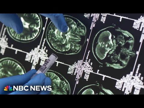 Research shows new blood tests could detect Alzheimer’s disease more accurately
