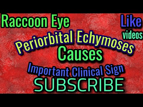 Periorbital Echymosis #shorts