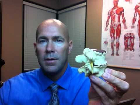 What is Subluxation? Buzz word in chiropractic explained by Dr. Mike Robb of Fix24