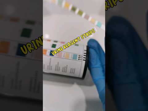 Urine tested negative for glucose ketones bilirubin #mls #mt #urinereagentstrip #medicaltechnologist