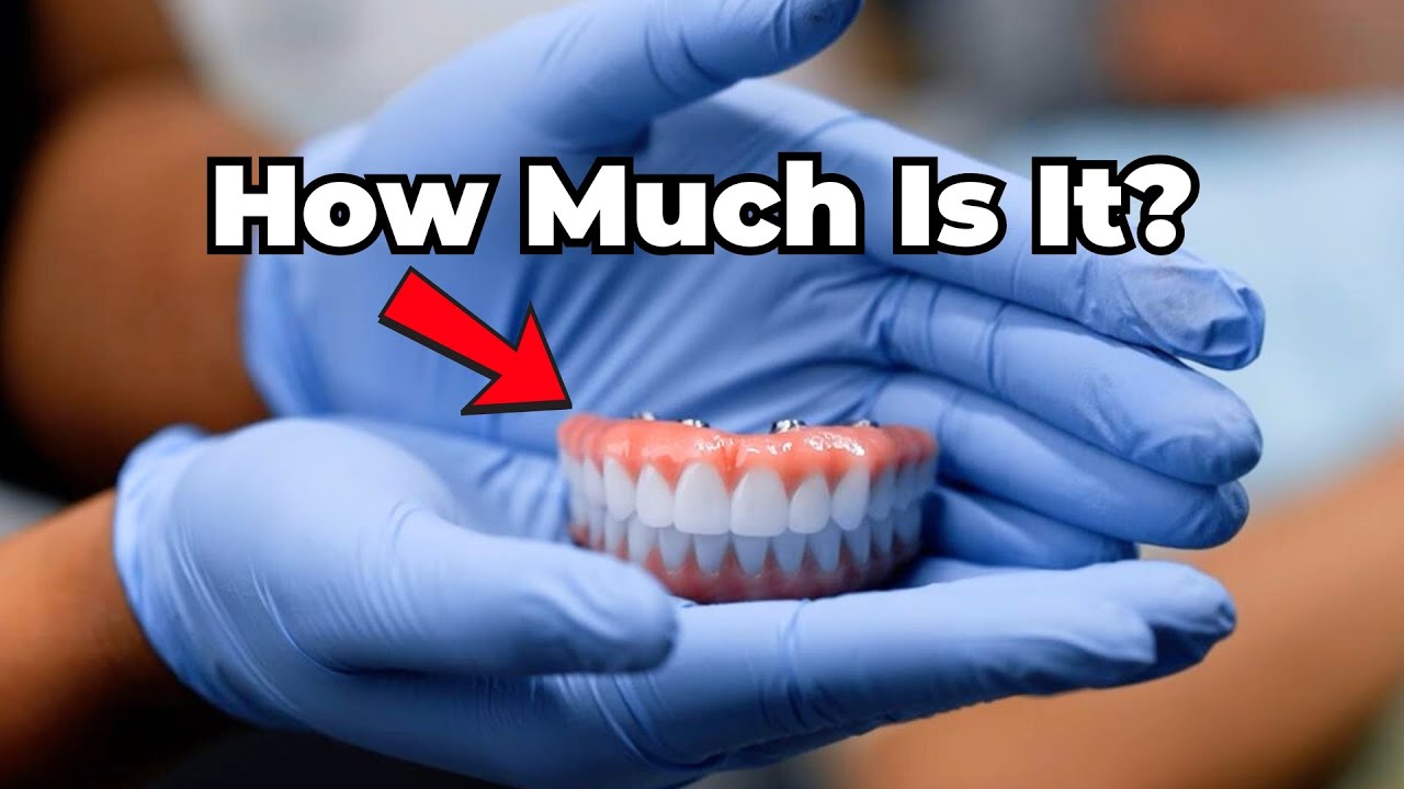 Full Mouth Dental Implant Cost in 2025