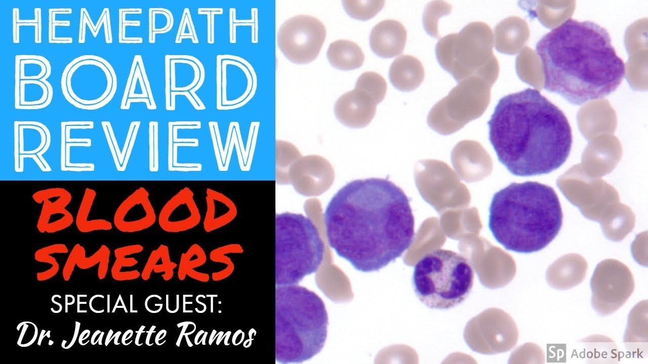 Hemepath & Hematology Board Review: Peripheral Blood Smears with Dr. Jeanette Ramos