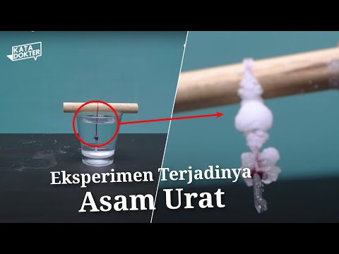 Proses Terbentuknya Asam Urat Dengan Percobaan Sederhana | Kata Dokter